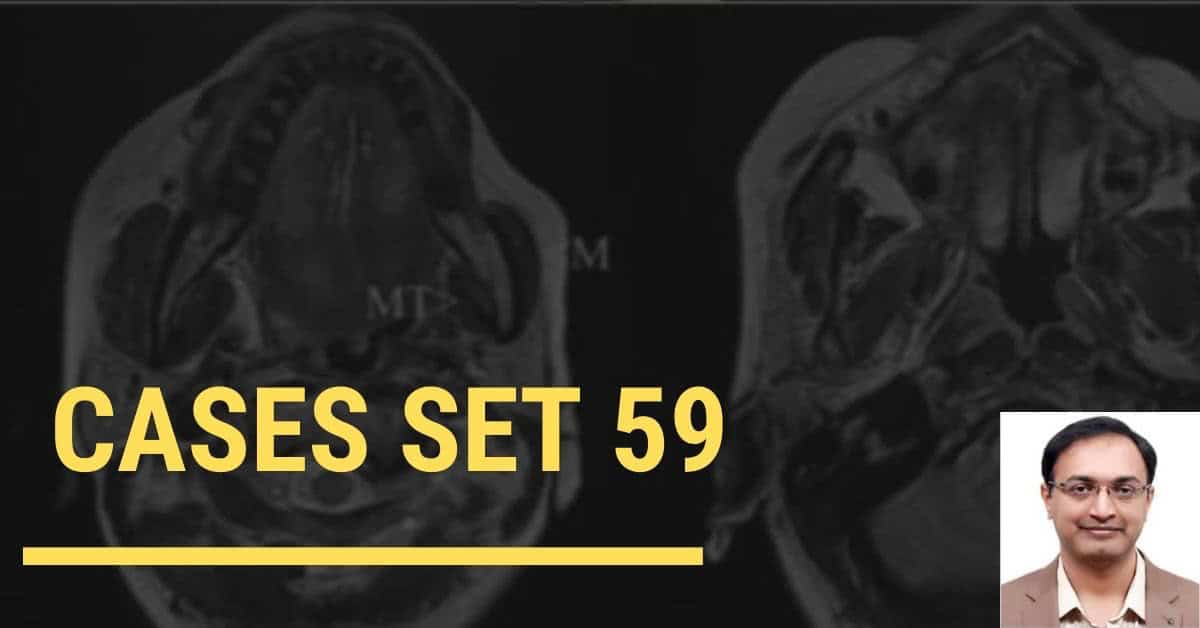 Classic Radiology Cases 3 | Spotters Set 57 | RadioGyan.com - RadioGyan