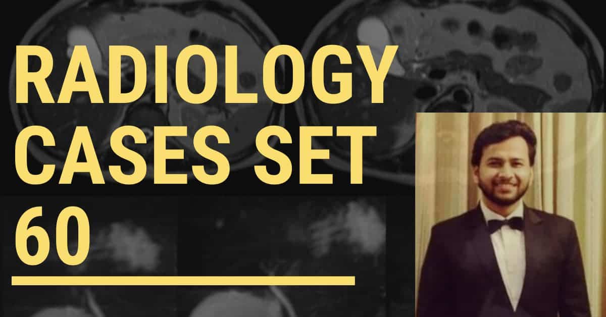 Learning Radiology Cases 3 | Spotters Set 60 | RadioGyan.com - RadioGyan