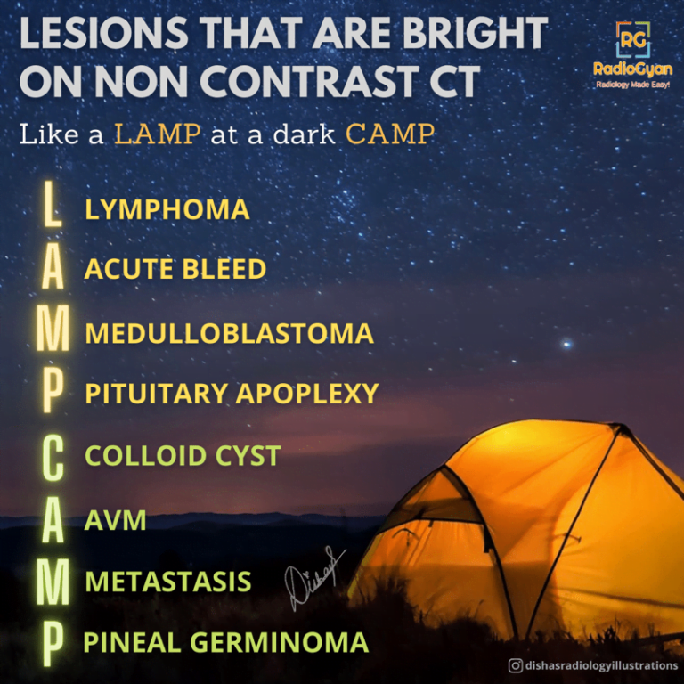 Radiology Mnemonics (Illustrated) - RadioGyan