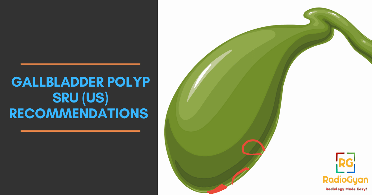 Gallbladder Polyp Management: SRU Guidelines & Recommendations