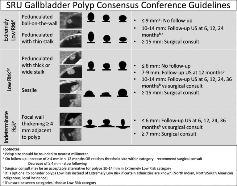 Gallbladder Polyp Recommendation Tool [SRU Guidelines] - RadioGyan