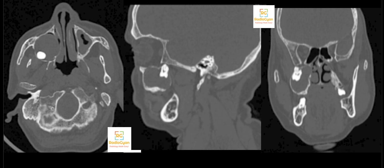 Radiology OSCE Case 153 - RadioGyan