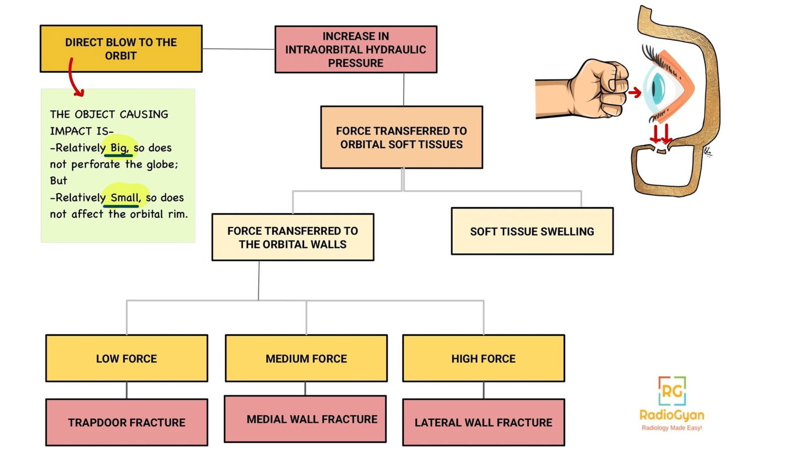 Blow out fracture of the Orbit | Radiology Case | - RadioGyan