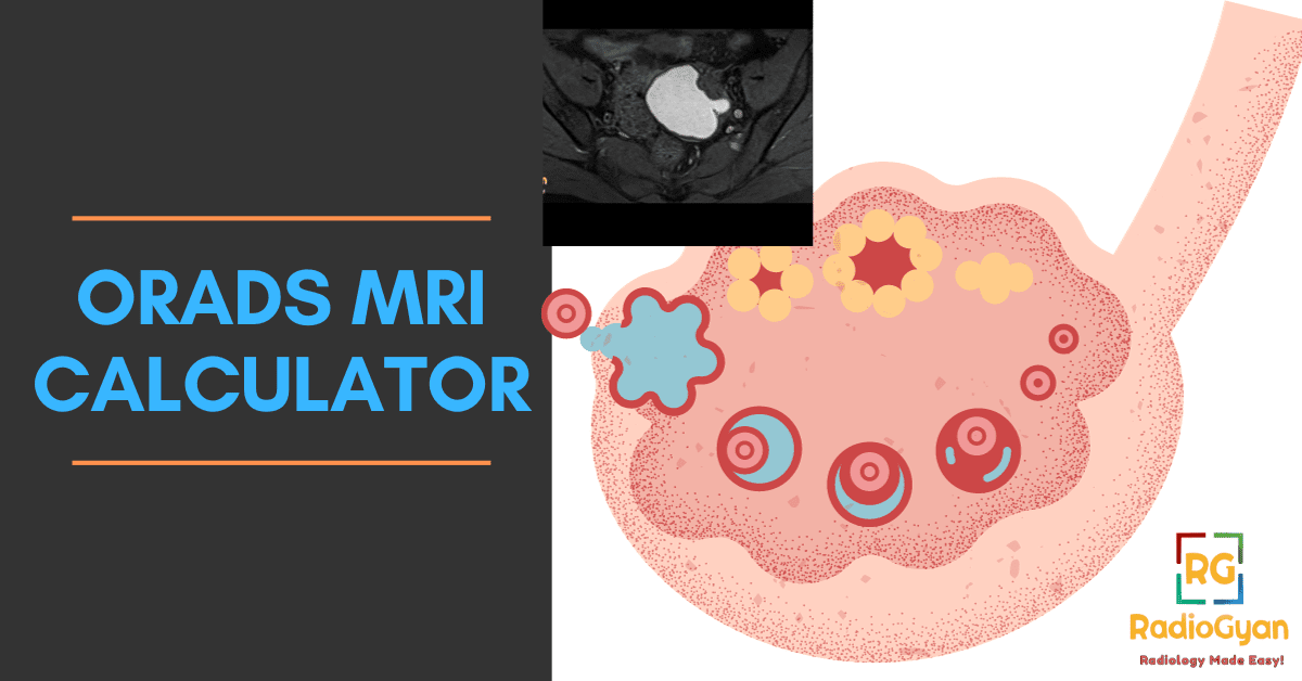 O-RADS MRI Calculator - RadioGyan