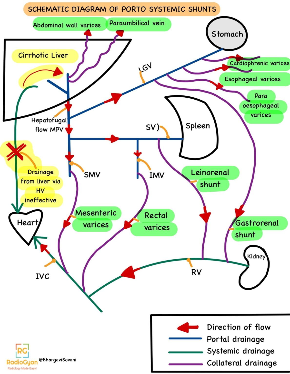 Cirrhosis and Portal Hypertension - RadioGyan