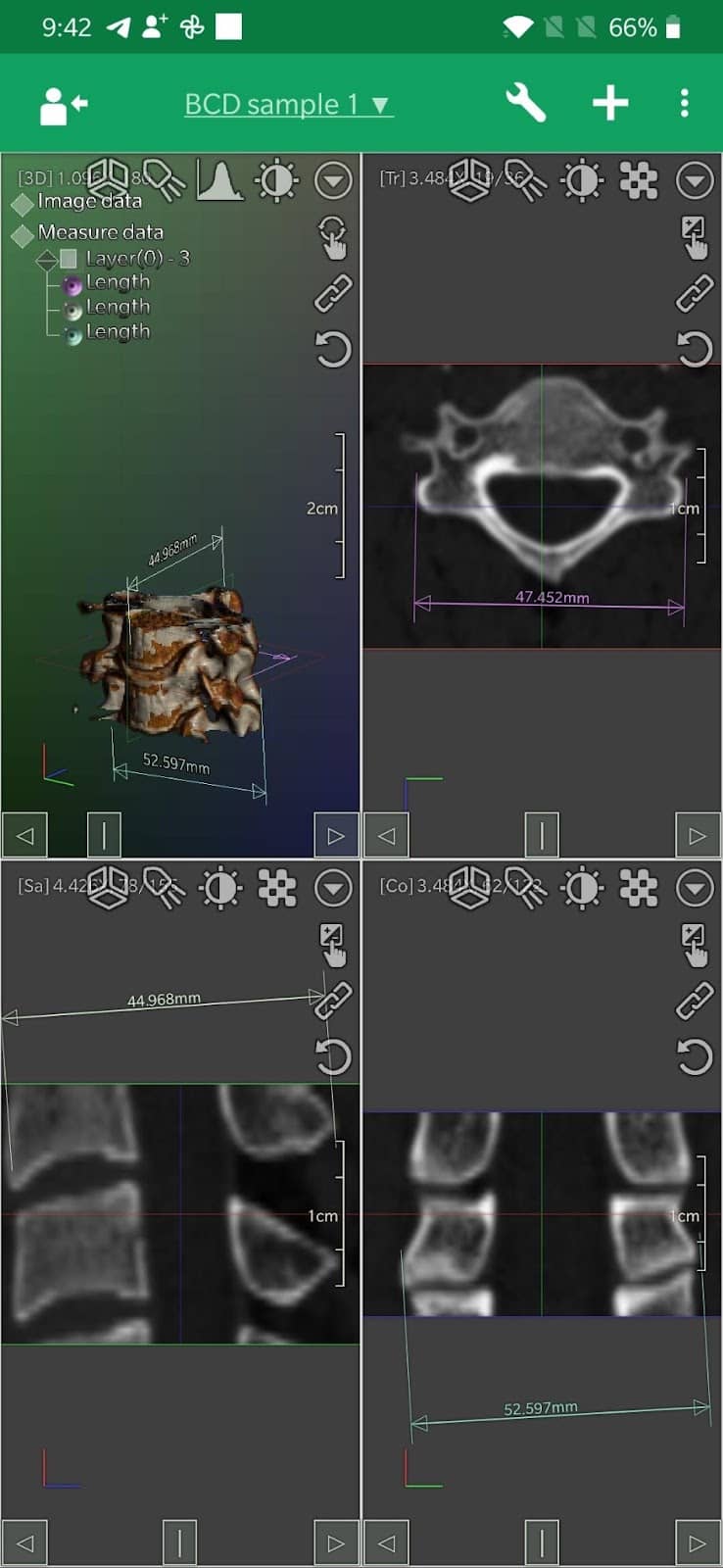 Best DICOM Viewers for Windows, MacOS, Web & Mobile - 2024 - RadioGyan