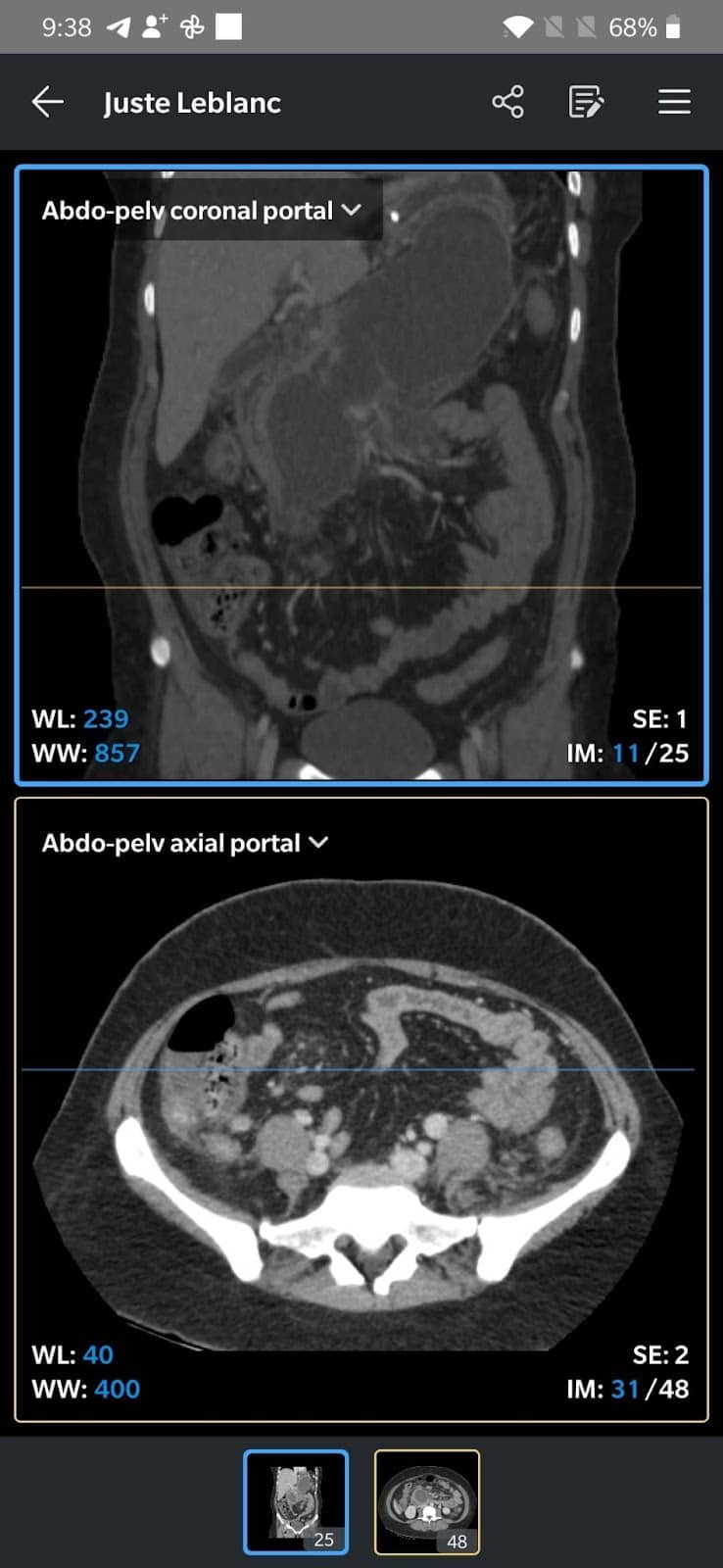 Best DICOM Viewers for Windows, MacOS, Web & Mobile - 2024 - RadioGyan