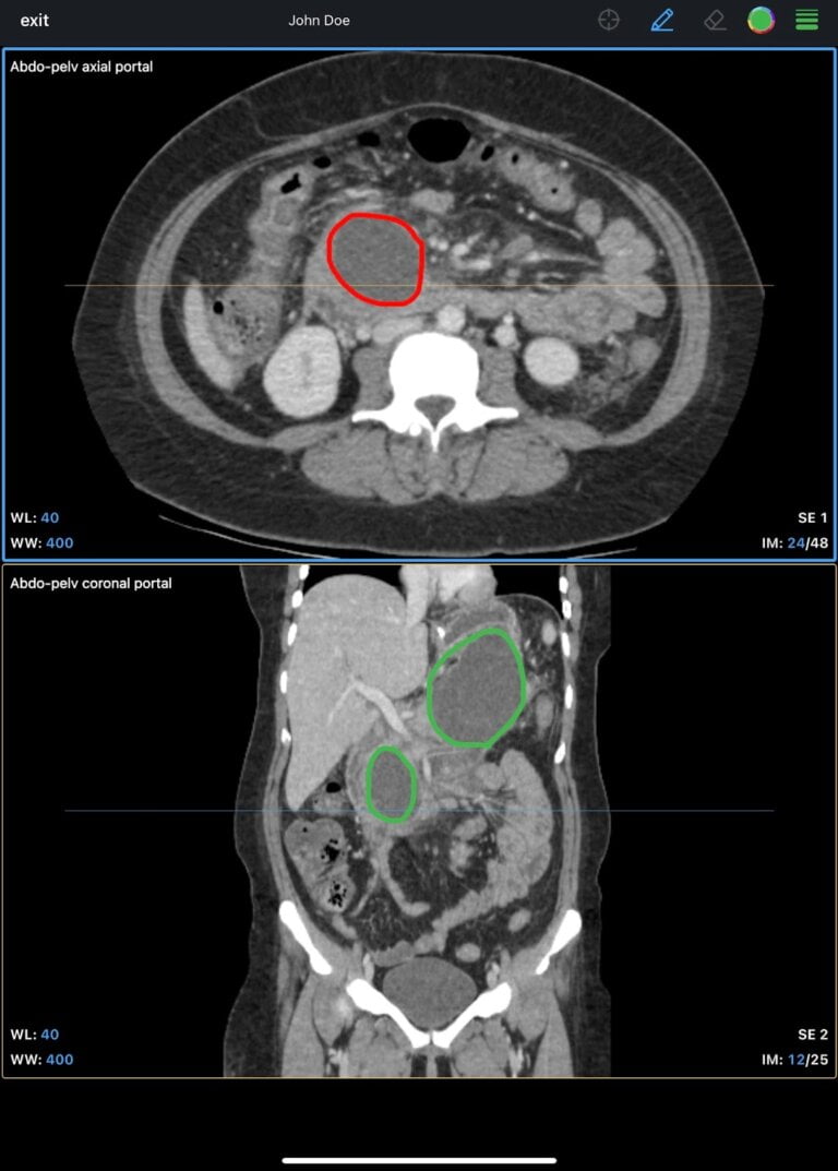 Best DICOM Viewers for Windows, MacOS, Web & Mobile - 2024 - RadioGyan