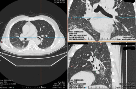 Best DICOM Viewers for Windows, MacOS, Web & Mobile - 2024 - RadioGyan