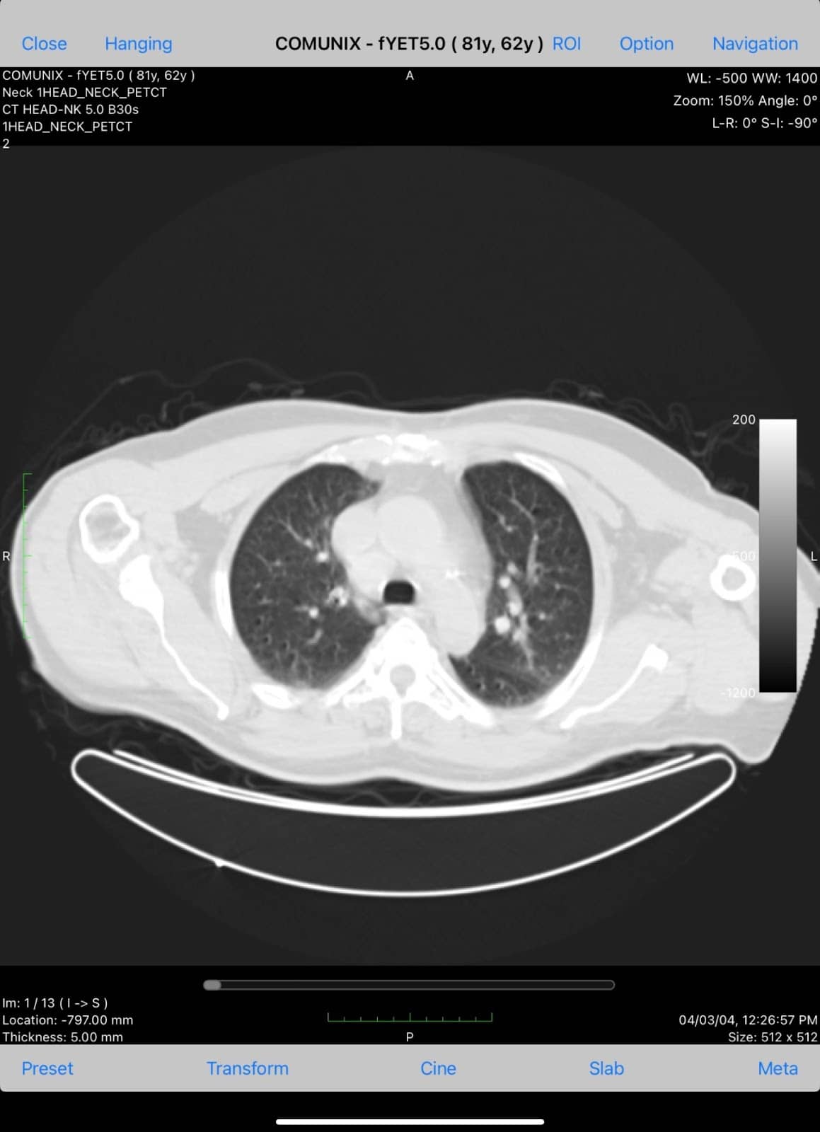 Best DICOM Viewers for Windows, MacOS, Web & Mobile - 2024 - RadioGyan