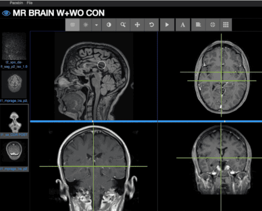 Best DICOM Viewers for Windows, MacOS, Web & Mobile - 2024 - RadioGyan