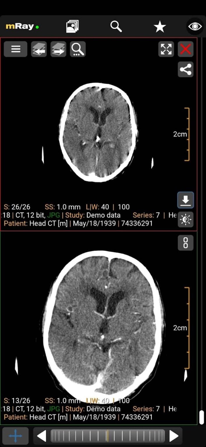 Best DICOM Viewers for Windows, MacOS, Web & Mobile - 2024 - RadioGyan