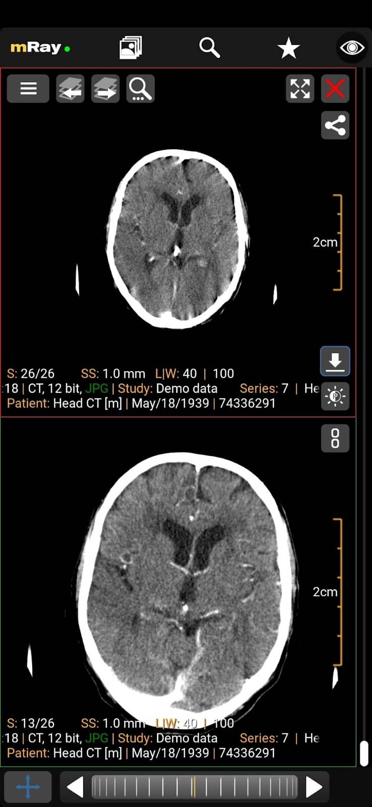 Best DICOM Viewers for Windows, MacOS, Web & Mobile - 2024 - RadioGyan