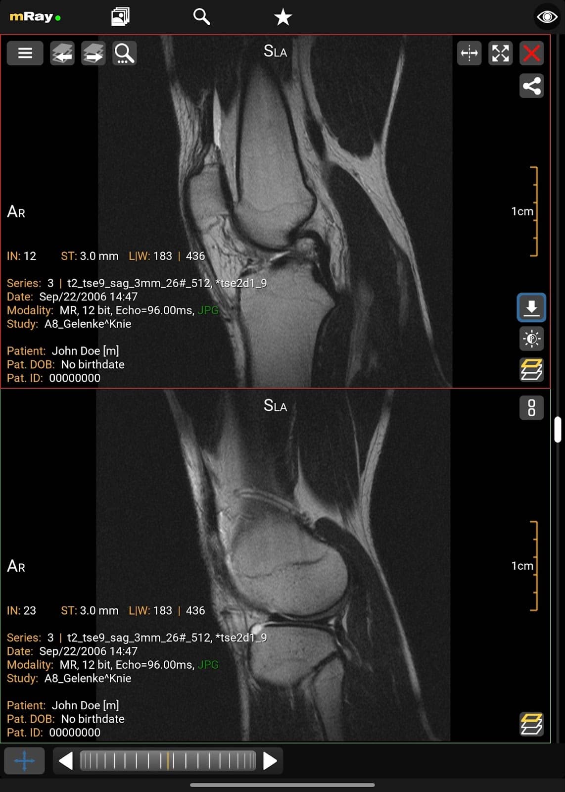 Best DICOM Viewers for Windows, MacOS, Web & Mobile - 2024 - RadioGyan